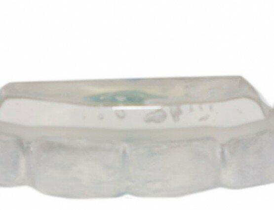 Bradford-Family-Dentistry-anterior-deprogrammer-555x426 - Bradford ...