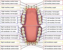 Human Teeth Dental Charts - Bradford Family Dentistry