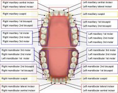 Human Teeth Dental Charts - Bradford Family Dentistry