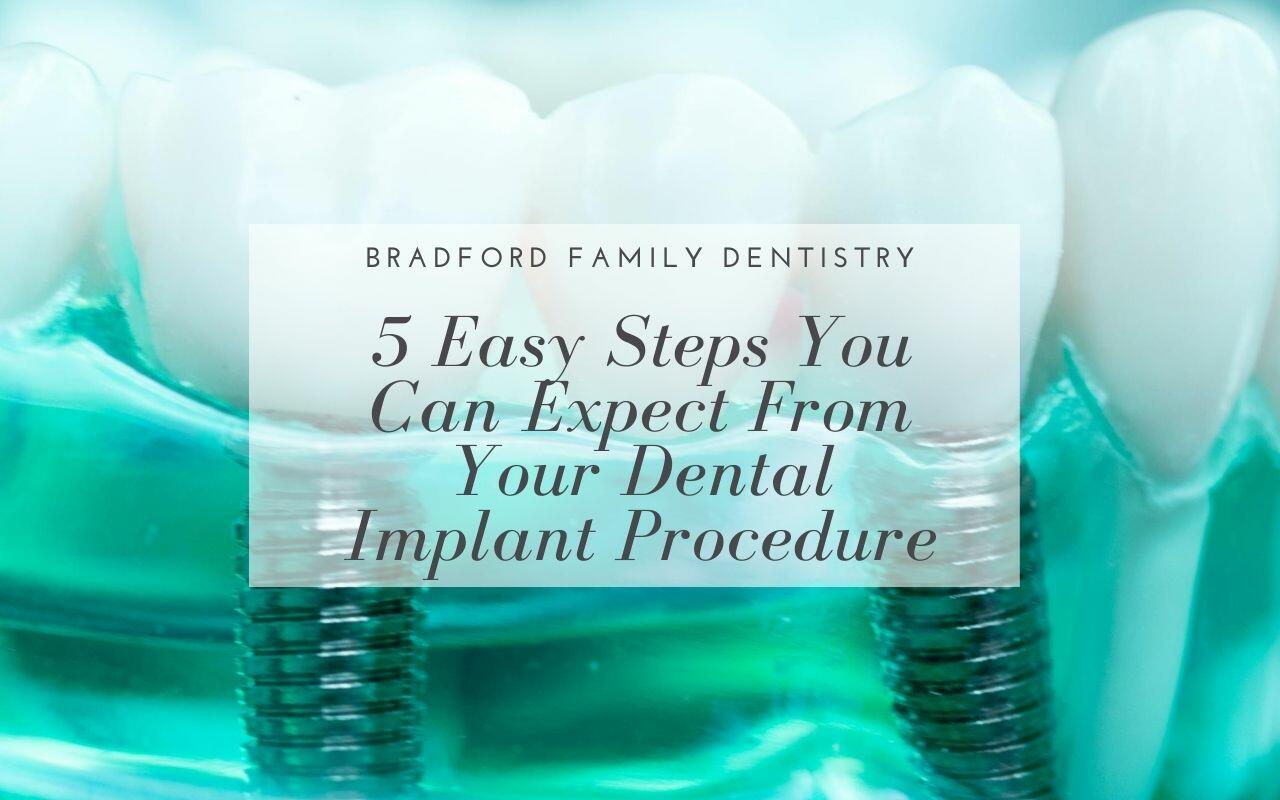 5 Easy Steps You Can Expect From Your Dental Implant Procedure ...