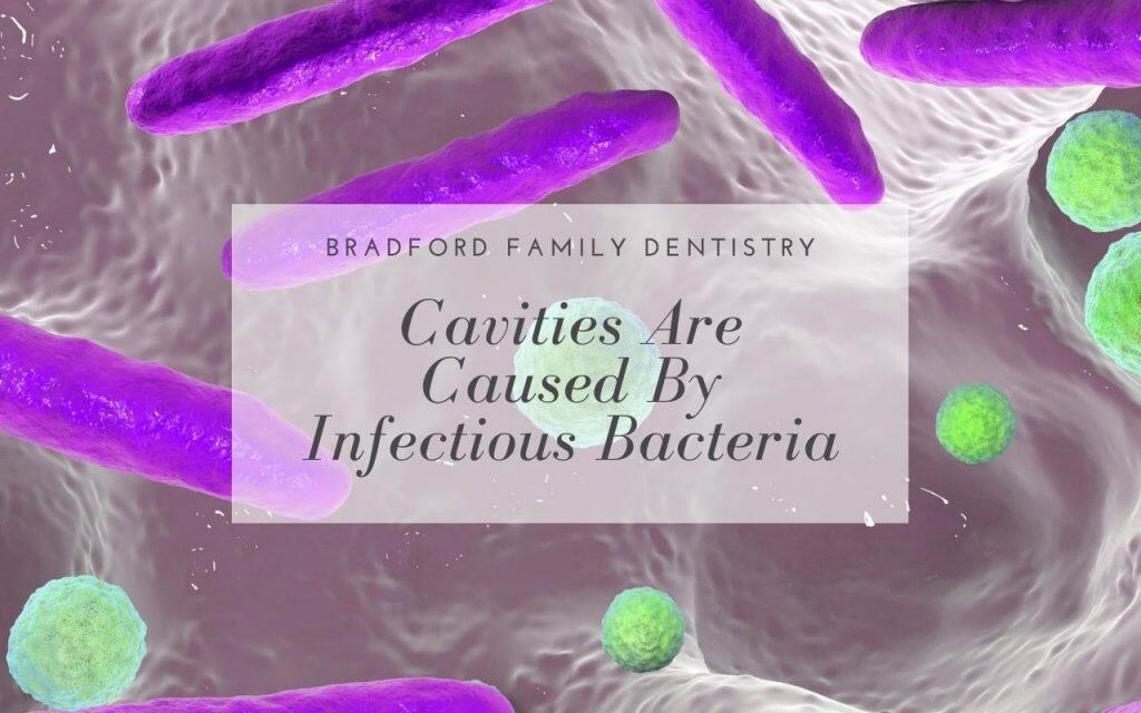 Cavities Are Caused By Infectious Bacteria - Bradford Family Dentistry