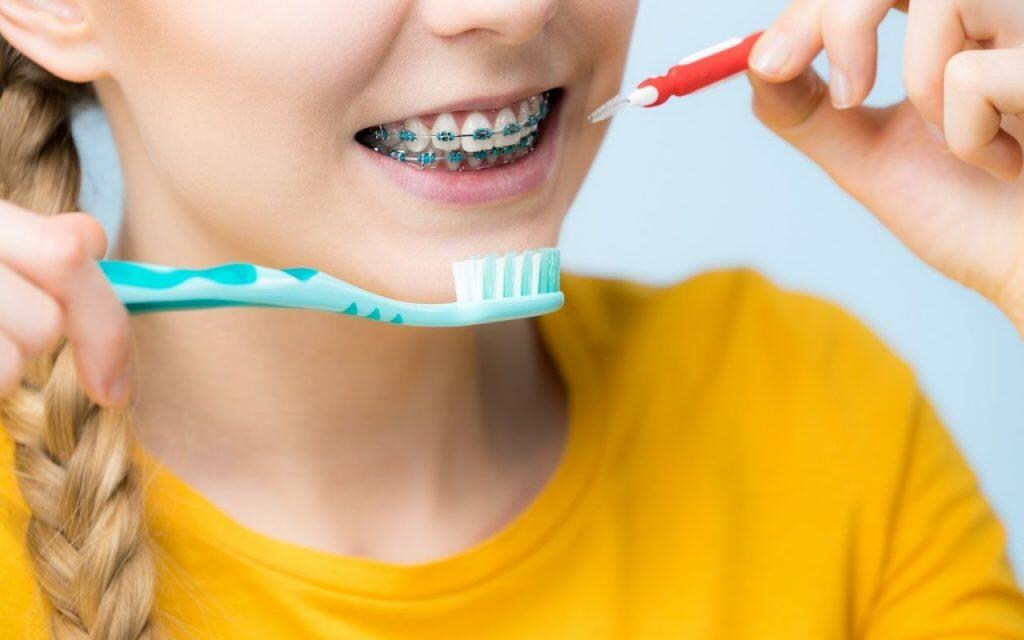 The Definitive Guide To Cleaning Teeth With Braces - Bradford Family ...