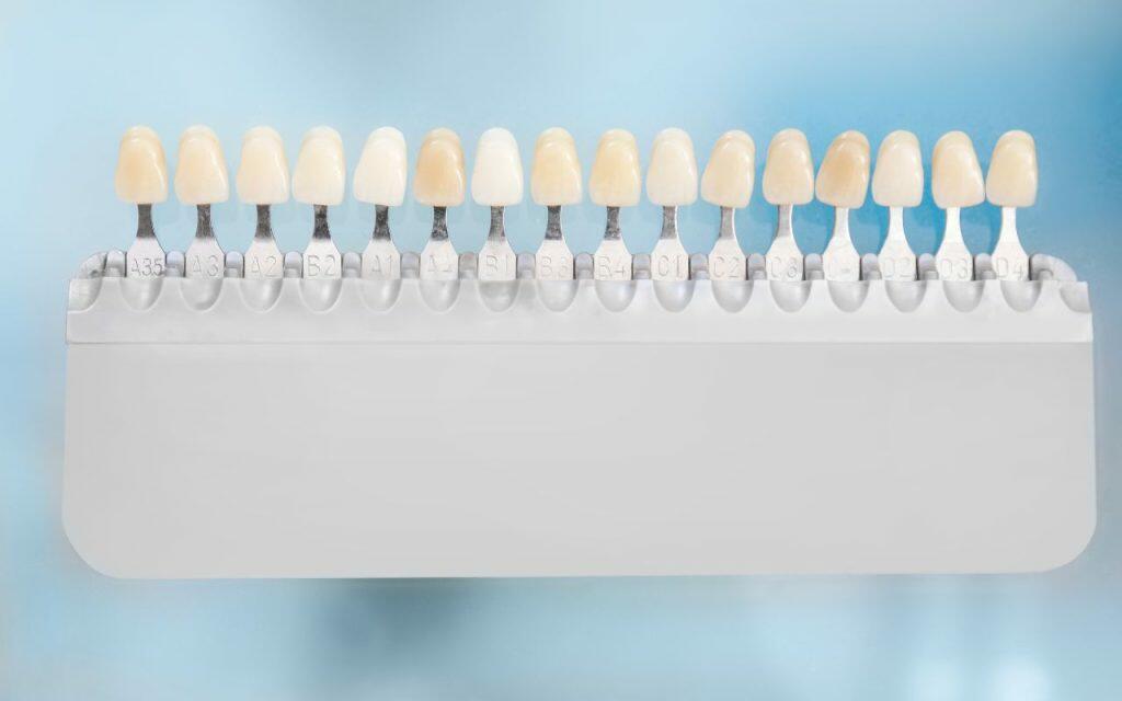 Are You Making Your Yellow Teeth Worse? - Bradford Family Dentistry